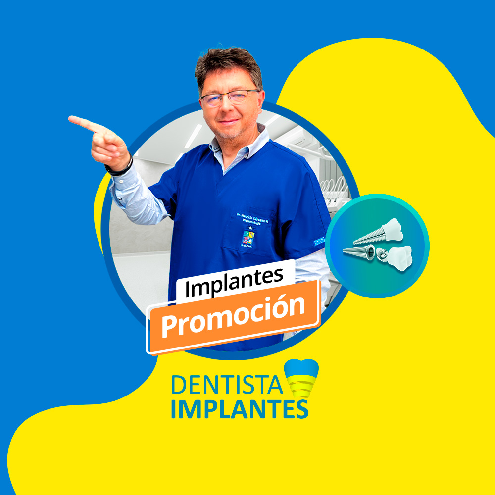 Promoción Implantes Dentales $579.000 - Dentista Implantes