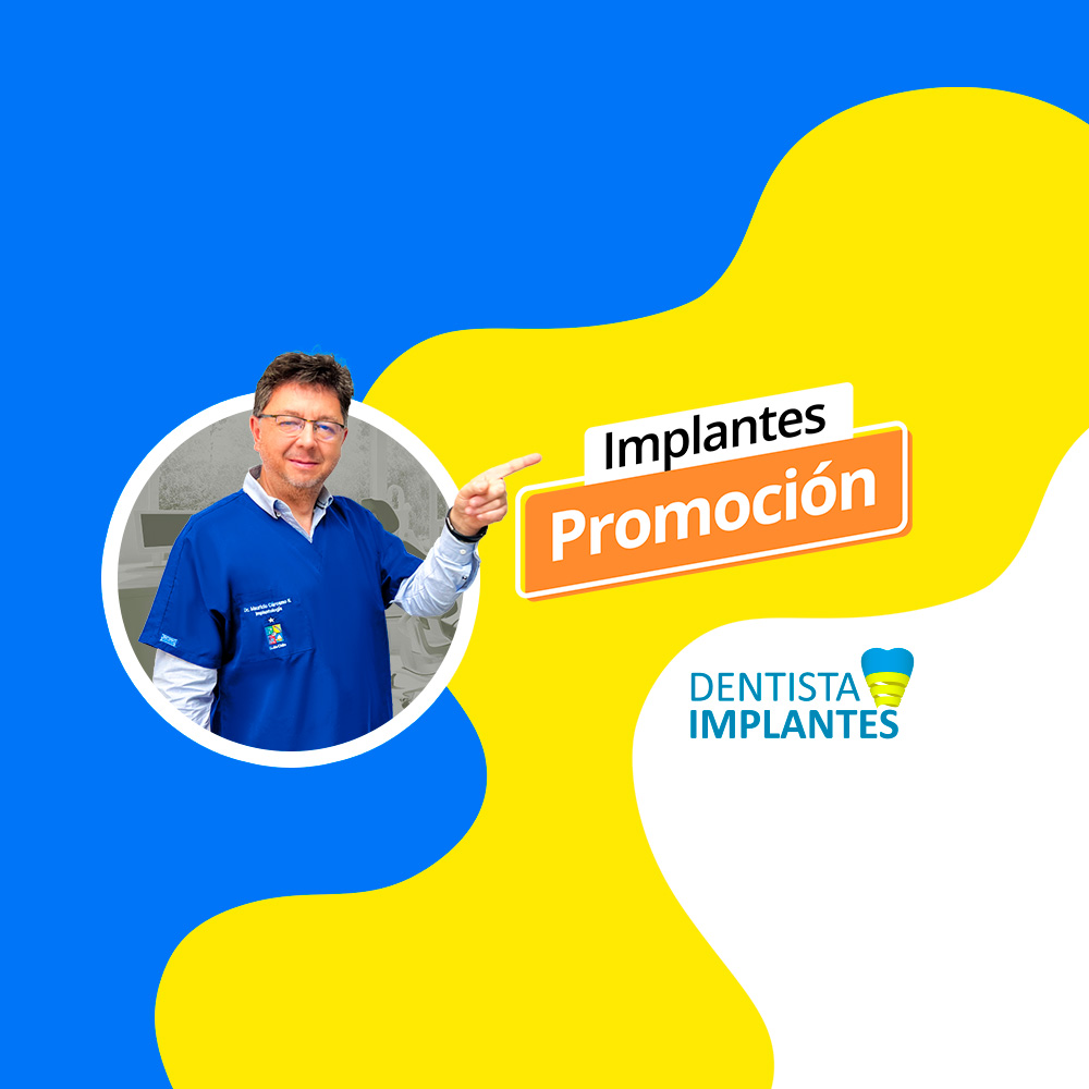 Promoción Implantes Dentales $579.000 - Dentista Implantes